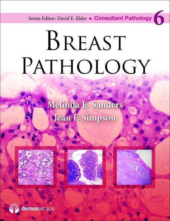 Breast Pathology (ebook), Melinda Sanders | 9781617051173 | Boeken | bol