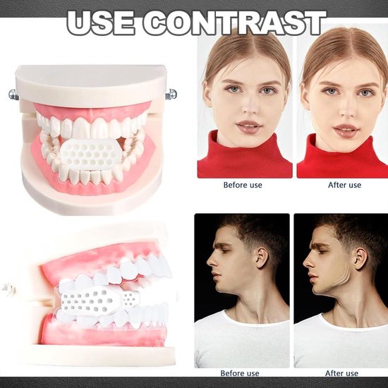 6 stuks Jaw Trainer - Oefening en kaaktraining - dubbele kin trainer ...