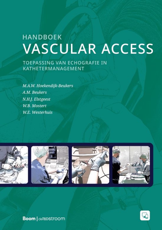Handboek vascular access | 9789024465132 | M.A.W. Hoekendijk- Beukers ...