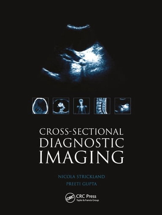 Cross-sectional Diagnostic Imaging (ebook), Nicola Strickland ...
