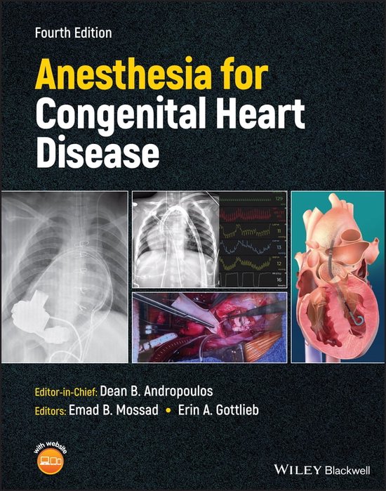 Anesthesia for Congenital Heart Disease (ebook), Dean B. Andropoulos ...