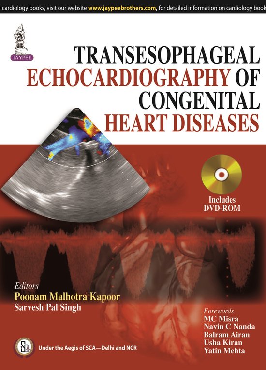 Transesophageal Echocardiography of Congenital Heart Diseases | 9789351522195 | Poonam... | bol