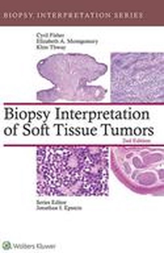 Biopsy Interpretation Series - Biopsy Interpretation of Soft Tissue ...