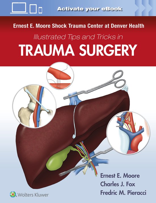 Ernest E. Moore Shock Trauma Center at Denver Health Illustrated Tips and Tricks in... | bol.com