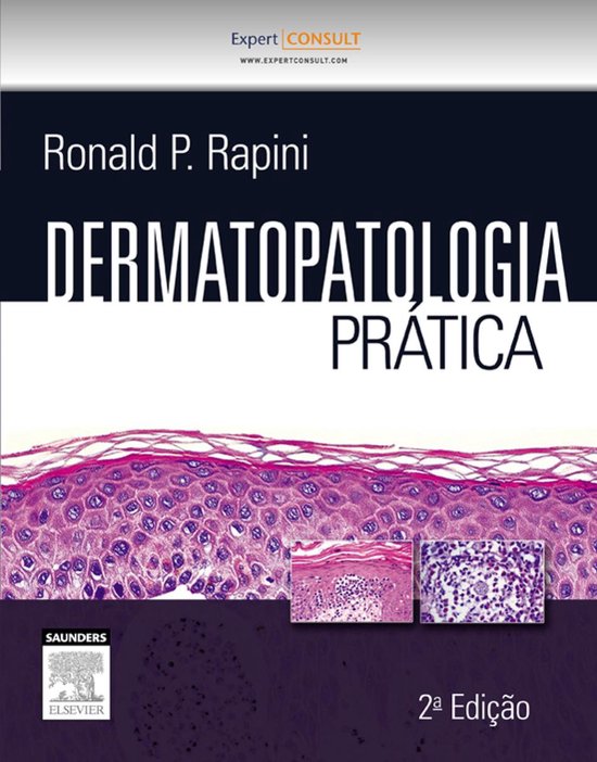 Dermatopatologia Prática (ebook), Ronald P. Rapini | 9788535269789 | Boeken | bol.com