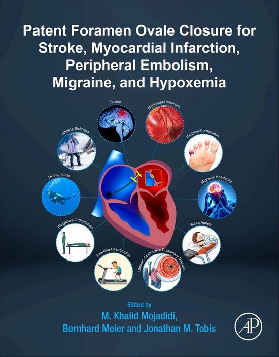 Patent Foramen Ovale Closure for Stroke, Myocardial Infarction ...