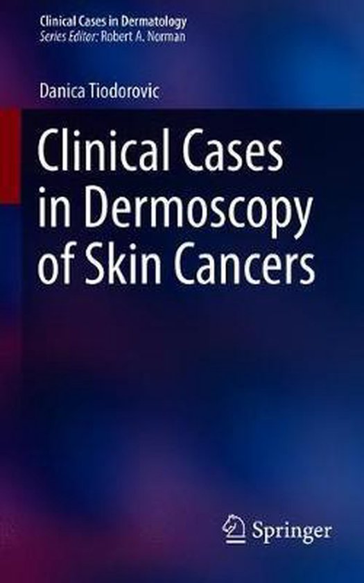 Clinical Cases in Dermatology- Clinical Cases in Dermoscopy of Skin ...