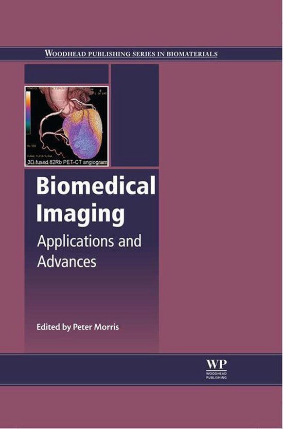 Biomedical Imaging (ebook), Peter Morris | 9780857097477 | Boeken | bol.com