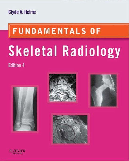 Fundamentals of Skeletal Radiology E-Book (ebook), Clyde A. Helms ...