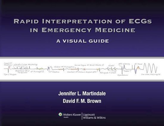 Rapid Interpretation of ECGs in Emergency Medicine, M.D. Martindale ...