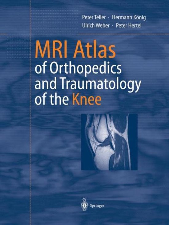 MRI Atlas of Orthopedics and Traumatology of the Knee | 9783642628856 ...