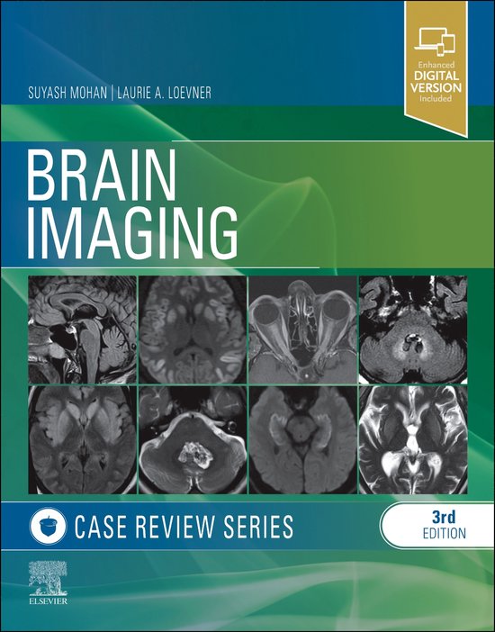 Brain Imaging Case Review Series, Laurie L. Loevner | 9781455774852 ...