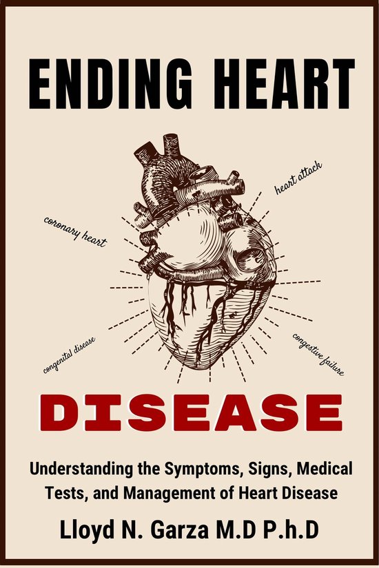 ENDING HEART DISEASE (ebook), Lloyd N. Garza M.D P.h.D | 1230006167363 ...