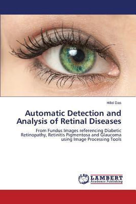 Automatic Detection and Analysis of Retinal Diseases | 9783659574153 | Das Hillol | Boeken | bol.com