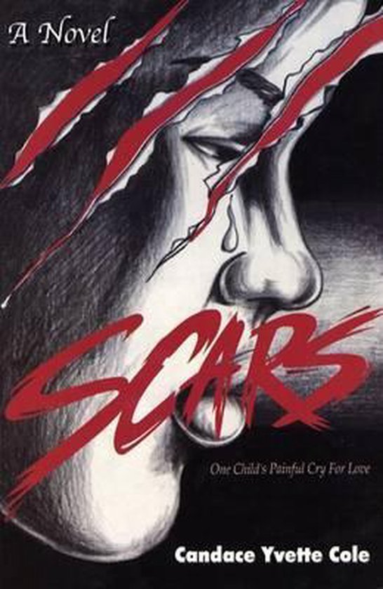 Scars, Candice Yvette Cole | 9780967877945 | Boeken | bol