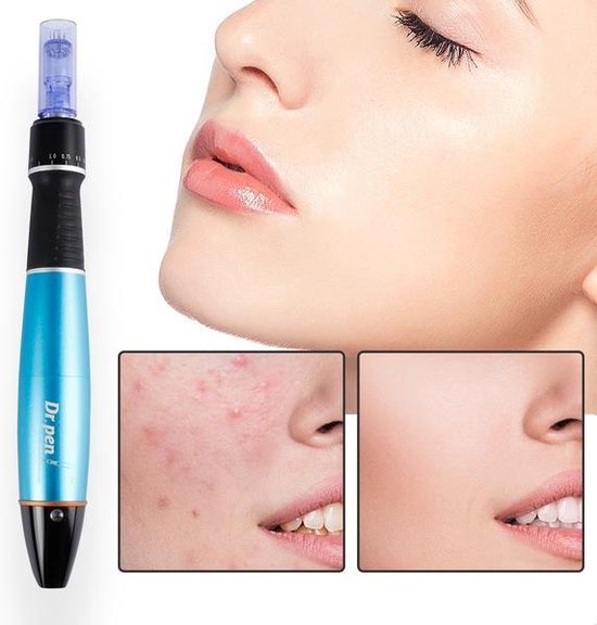Dr. Pen Microneedling Pen A1 - Draadloos - Rimpels - Littekens - 3mm | bol