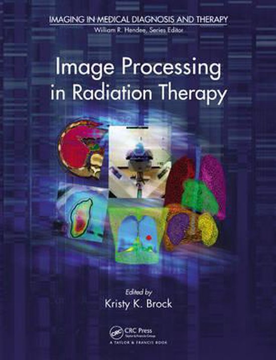 Image Processing in Radiation Therapy | 9781439830178 | Boeken | bol.com
