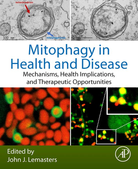 Mitophagy in Health and Disease | 9780443152603 | John J. Lemasters | Boeken | bol