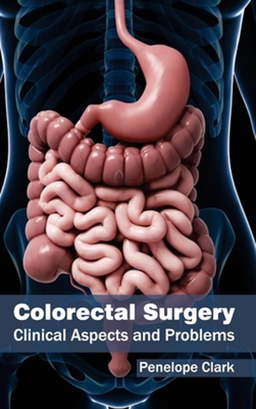 Colorectal Surgery | 9781632410931 | Boeken | bol.com