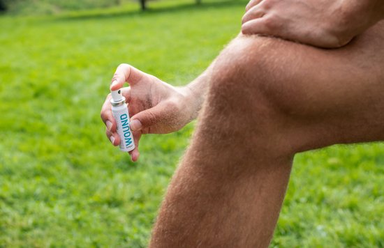 WOUND wondspray - 100% natuurlijk - voor (open) wonden - versnelt het ...