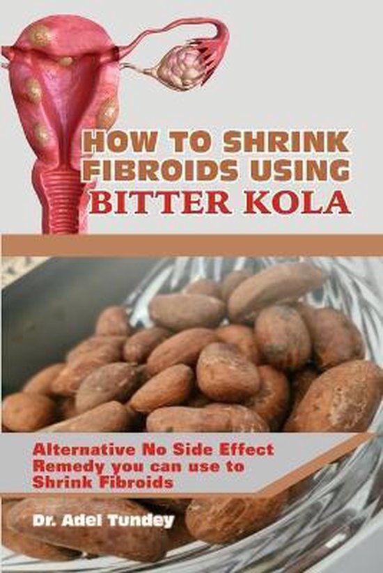 How to Shrink Fibroids Using Bitter Kola, Adel Tundey | 9798687268769 ...