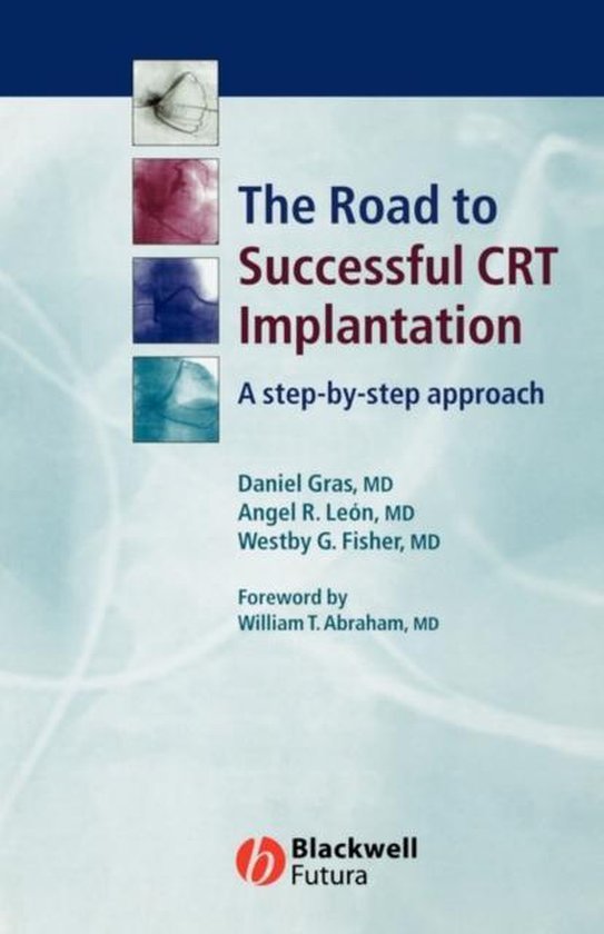 The Road to Successful CRT Implantation: A Step-By-Step Approach ...