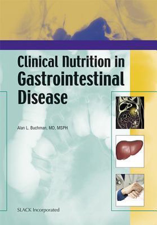 Clinical Nutrition in Gastrointestinal Disease | 9781556426971 | Alan ...