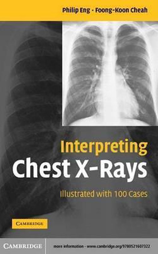 Interpreting Chest X-Rays (ebook), Philip Eng | 9780511074035 | Boeken | bol.com