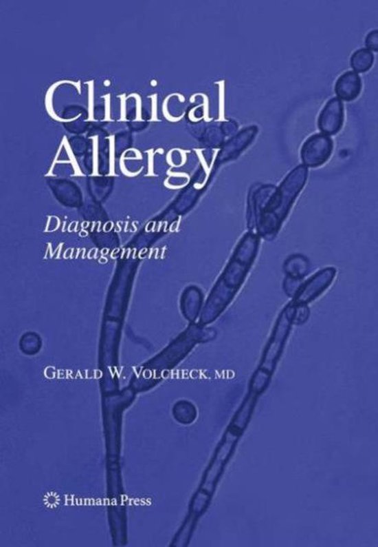 Clinical Allergy: Diagnosis and Management | 9781627038386 | Gerald W ...