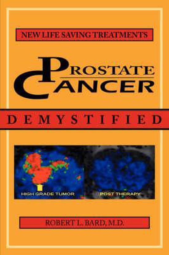 Prostate Cancer Demystified, Robert L. Bard, M.D. | 9781425996468 ...
