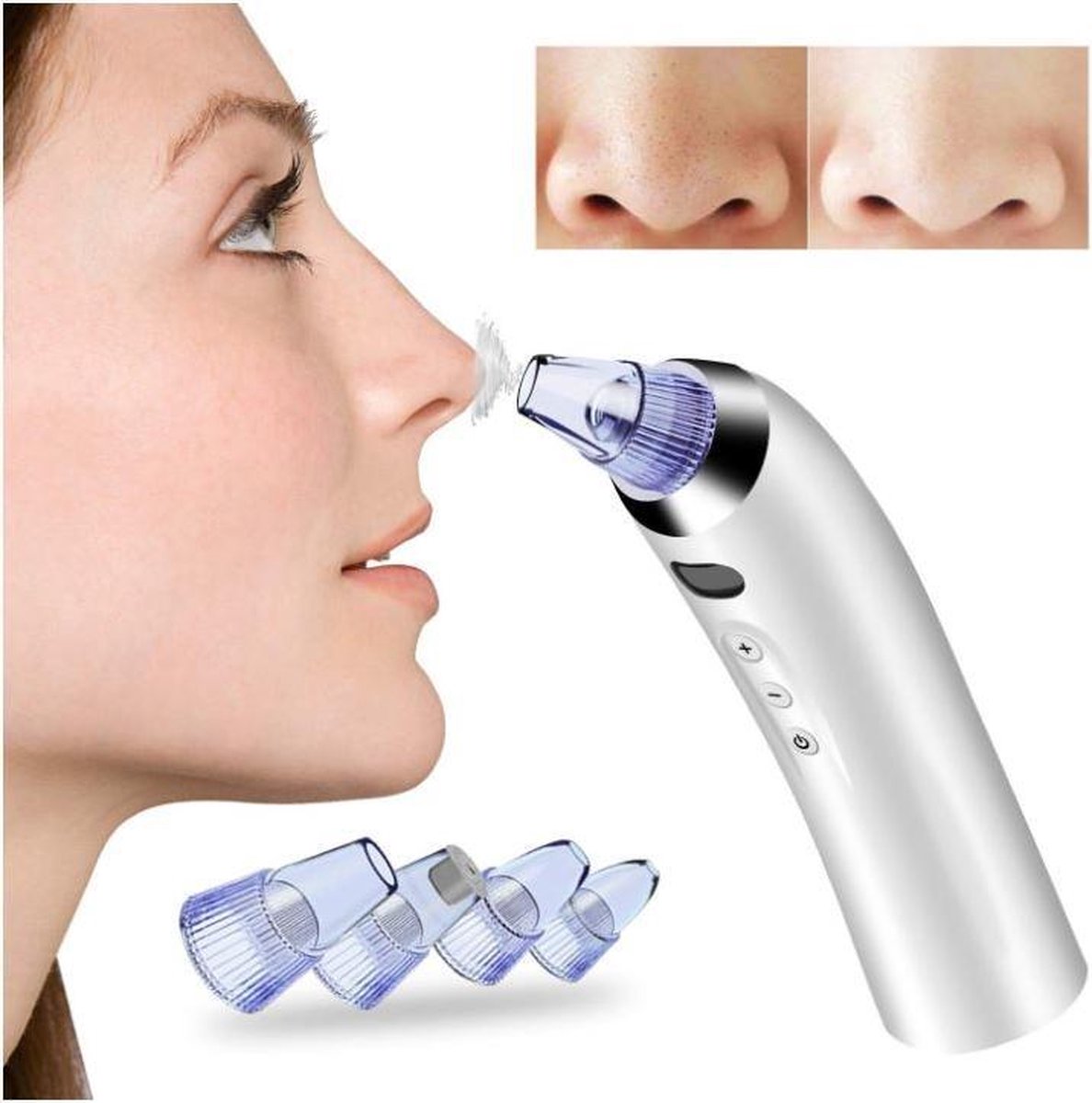 Blackhead Remover – Verwijderd Mee-Eters en Reinigt Verstopte Poriën ...