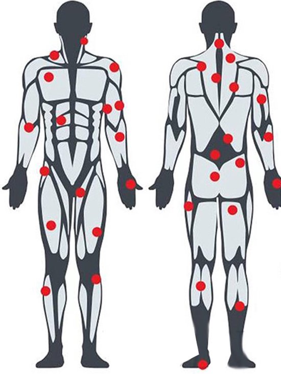Aurgan Thera Cane - Curve - Trigger point - spierknoppen - Fysio ...