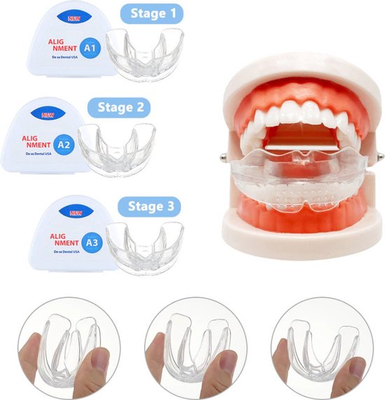 Rechte Tanden Beugel - Retainer Voor Rechte Tanden - Rechte Tanden ...