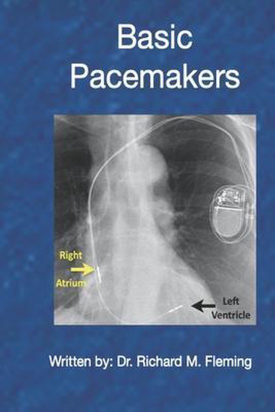 How to Read an Electrocardiogram.- Basic Pacemakers | 9798573957340 ...