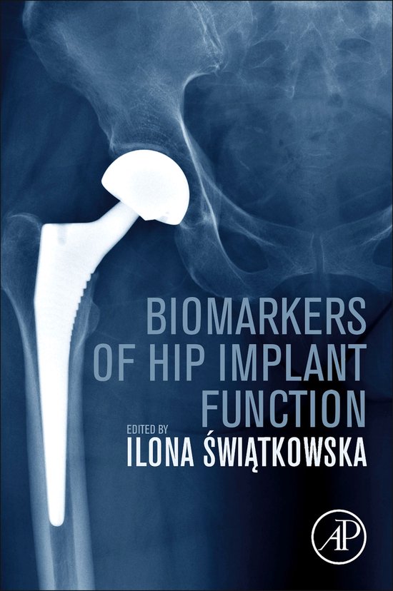 Biomarkers of Hip Implant Function (ebook) | 9780128217429 | Boeken | bol