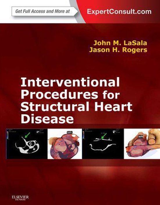 Interventional Procedures for Adult Structural Heart Disease (ebook ...