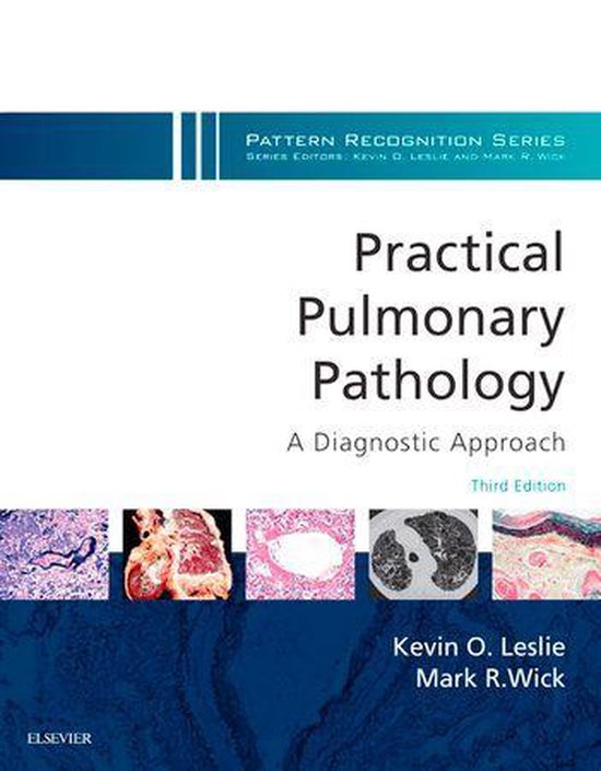 Pattern Recognition - Practical Pulmonary Pathology: A Diagnostic ...