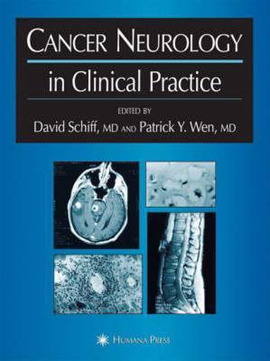 Cancer Neurology in Clinical Practice | 9780896039223 | David Schiff | Boeken | bol