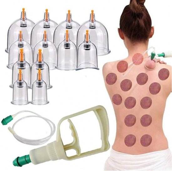 Cupping Set - 12 Delig - Cupping - 12 Cupping Cups In 6 Verschillende ...