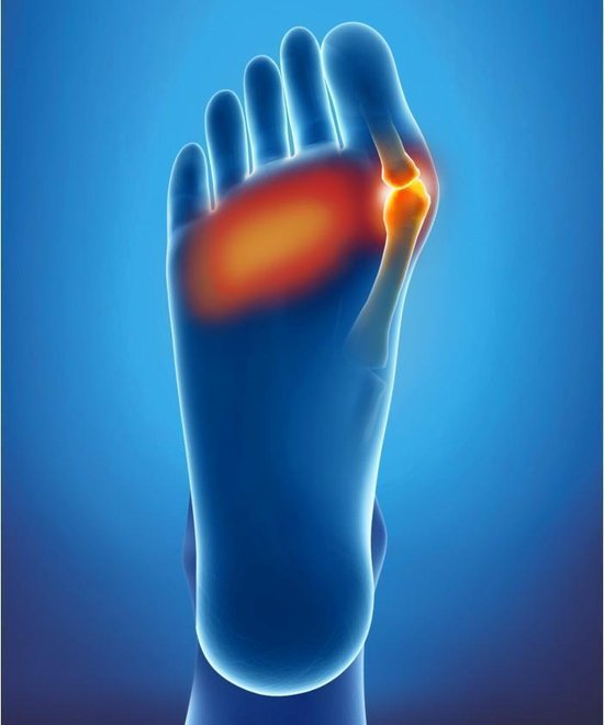 Epitact Dubbel Corrigerende Orthese met Epithelium Flex & Epithelium 26 ...