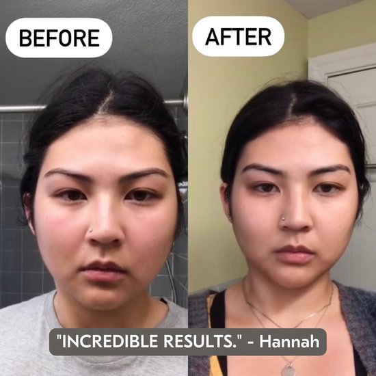 Mount Lai, The Black Obsidian Facial Spa Set, 1 x 2-delige set | bol