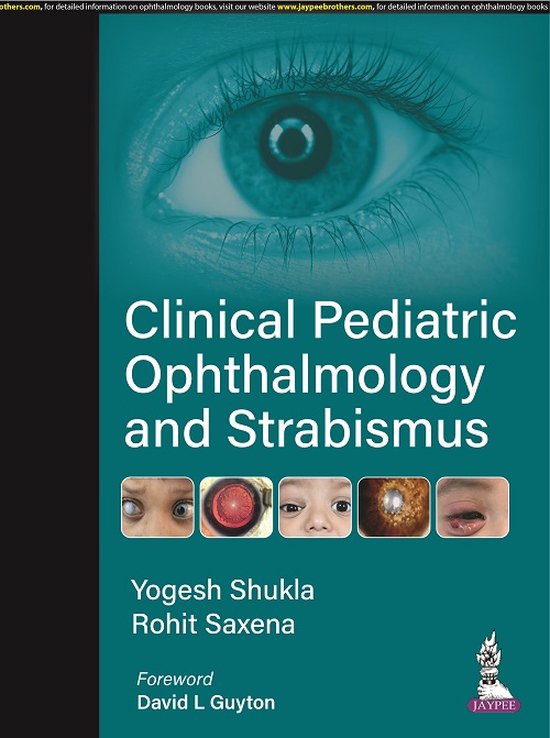 Clinical Pediatric Ophthalmology and Strabismus, Yogesh Shukla | 9789354653537 | Boeken | bol