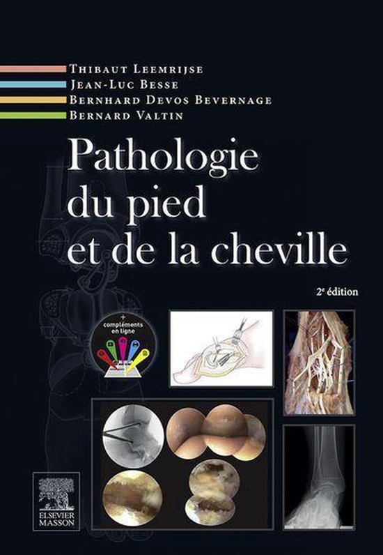 Pathologie du pied et de la cheville (ebook), Jean-Luc Besse ...
