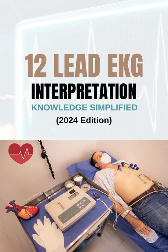 12 LEAD EKG INTERPRETATION KNOWLEDGE SIMPLIFIED (2024 Edition) (ebook ...