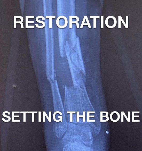 Restoration - Setting The Bone (ebook), Joshua Rhoades | 9798224046850 ...