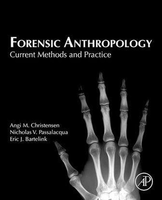 Forensic Anthropology (ebook), Angi M. Christensen | 9780124172906 | Boeken | bol
