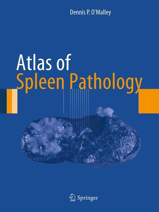 Atlas of Anatomic Pathology - Atlas of Spleen Pathology (ebook), Dennis ...