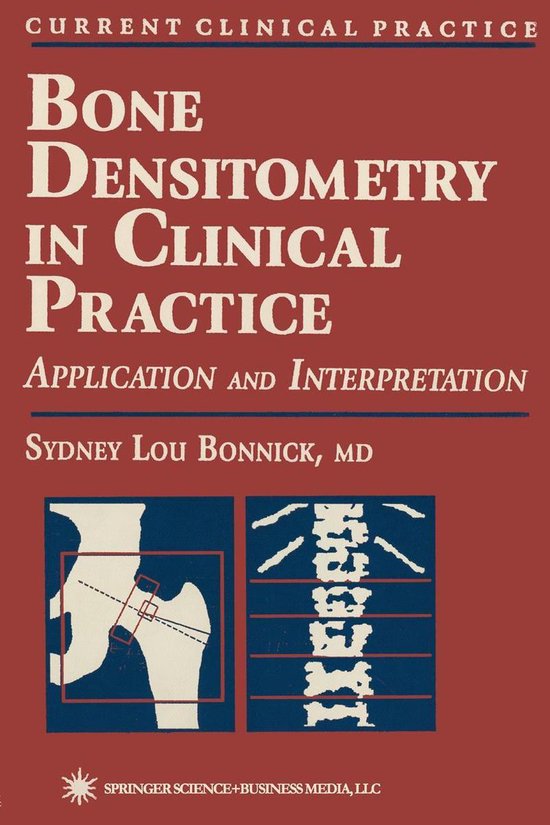 Current Clinical Practice - Bone Densitometry in Clinical Practice ...