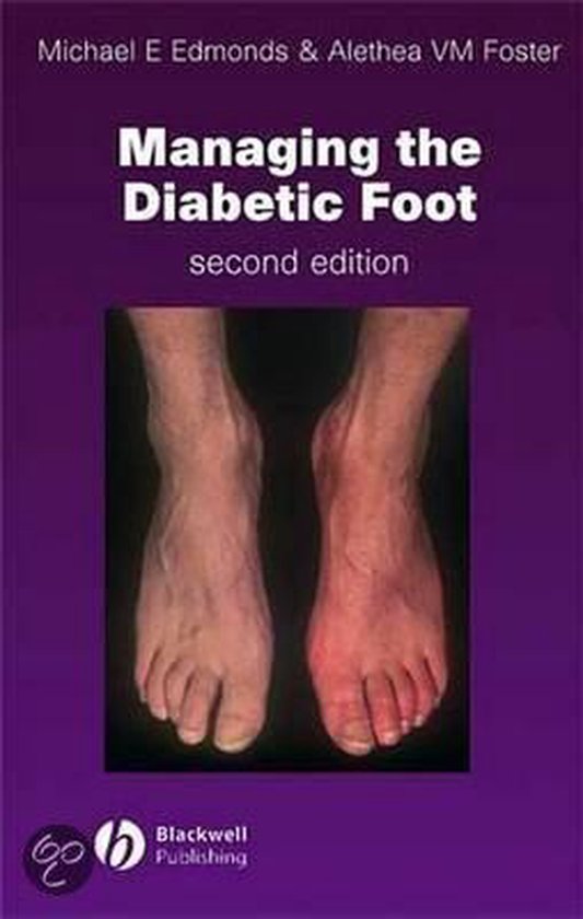 Managing the Diabetic Foot (ebook), Michael E Edmonds | 9780470751510 ...