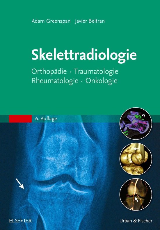Skelettradiologie (ebook), Adam Greenspan | 9783437171338 | Boeken ...